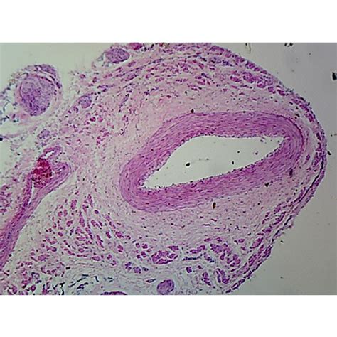Prepared Microscope Slidemedium Sized Artery And Vein
