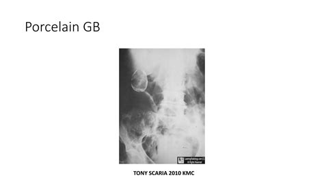 Hepatobiliary System Radiology Revision Notes Pdf