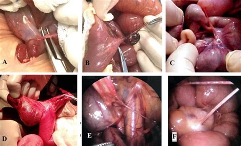 Surgical Exploration Of Some Cases With Mdb A The Mesenteric Download Scientific Diagram