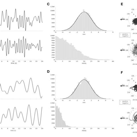 Features Of Ecrb Tendon Displacement And Velocity During Random Human
