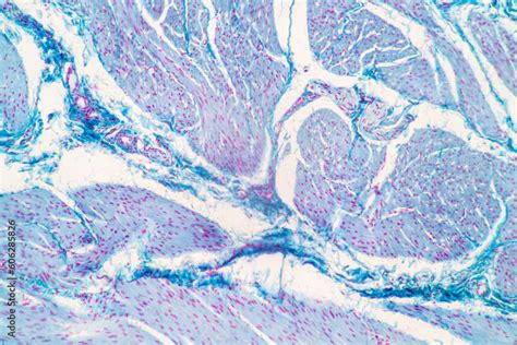 Showing Light Micrograph Of The Adrenal Gland And Urinary Bladder Human
