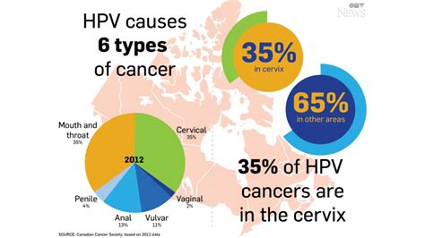 Health Officials Ramp Up Cancer Causing Hpv Testing Efforts Antigua