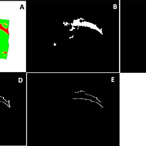 The Arcuate Border Extraction Was Performed With The Following Steps