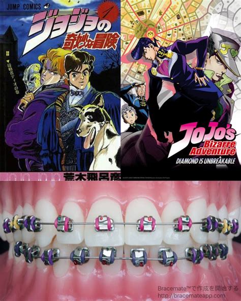 Pin On Bracemate Designs For Braces