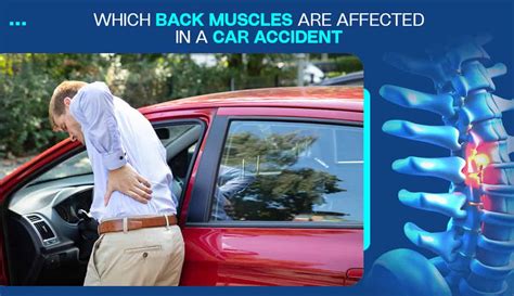 Back Injuries From Car Wrecks