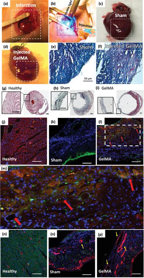 Figure 1 From In Vitro And In Vivo Analysis Of Visible Light Crosslinkable Gelatin Methacryloyl