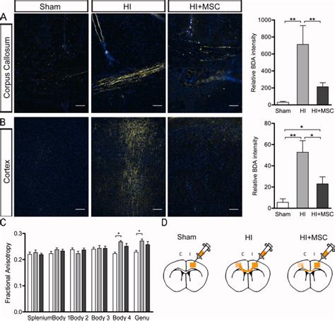 Connectivity Between Ipsilesional And Contralesional Motor Cortices At