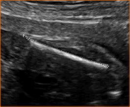 Ob Images