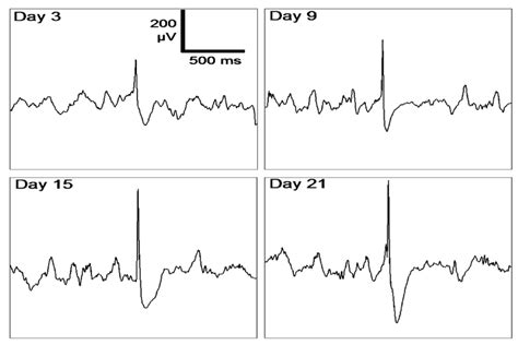 Time Domain Features Of Epileptic Spikes As Potential Bio Markers Of The Epileptogenesis Process