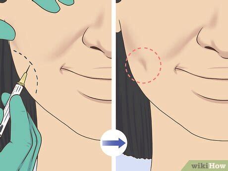 16 Types Of Dimples Every Kind Of Face Body Dimple