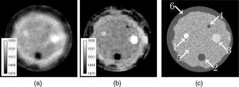 Reconstruction Of Physical Breast Phantom Using Older Ultrasound