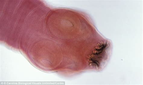 British Woman Nearly Died After Tapeworms Burrowed Into Her Brain While