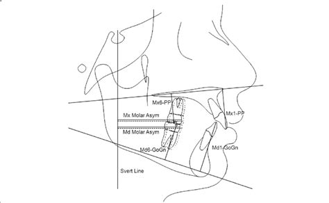 Skeletal And Dental Variables Angular Measurements Sna Snb Anb Download Scientific Diagram
