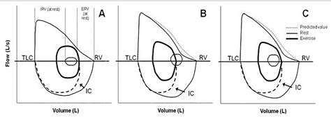 Figure 1 From Obesity Can Profoundly Alter Pulmonary Function And