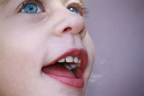 The Green Piece National Microcephaly Day