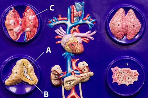 Lab Assignment 27 Flashcards Quizlet