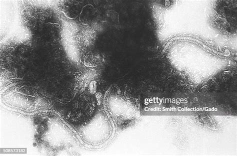 Respiratory Syncytial Virus Photos And Premium High Res Pictures