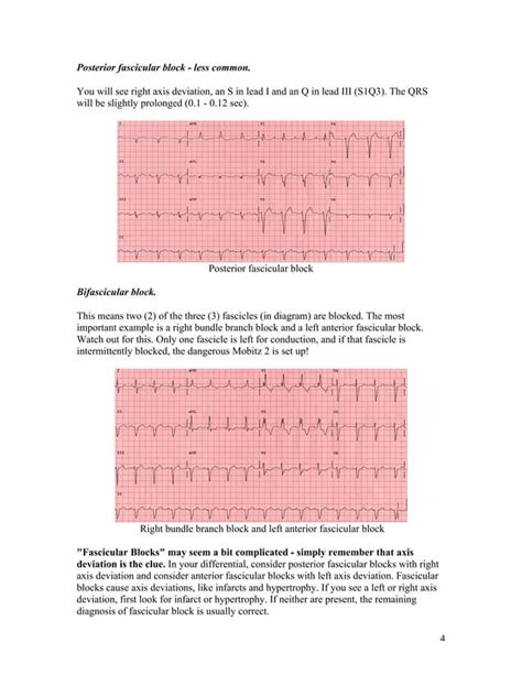 Ecg Ecg Abnormalities Pdf Heart And Cardiovascular Diseases
