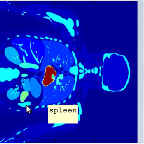 Construct Phantom Image A Tooltip Appears When The Mouse Cursor Hovers Download Scientific