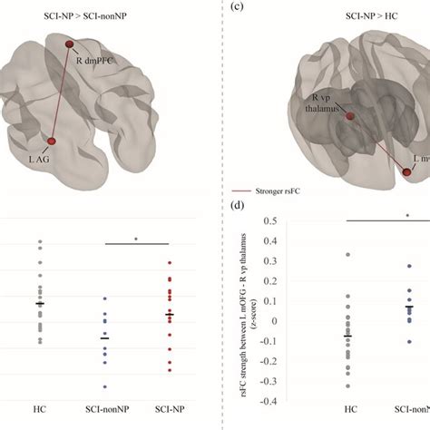 Lars Michels Senior Scientist Msc Phd Pd University Of Zurich Zürich Uzh Klinik Für