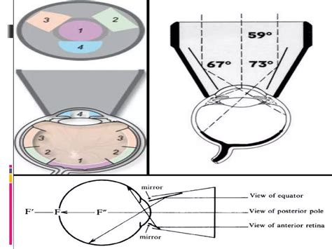 Gonioscopy Gonioscopic Lenses Principle And Clinical Aspects Pptx