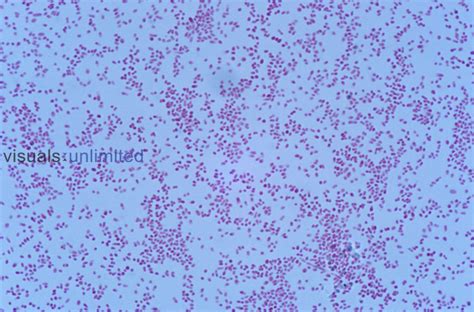 228659 Visuals Unlimited