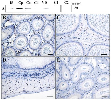 Meis 1 Presence In Adult Mouse Epididymis And Vas Deferens A Western Download Scientific