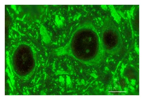 Map2 Expression In A Heterokaryon A Neuronal Nucleus Larger And Download Scientific Diagram