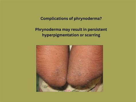 Vitamin A Dermatology Pptx