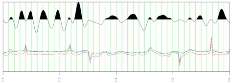 Complex Trace Attribute Overview Geophysical Insights