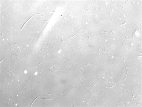 Fibre Analysis In Microscopy Images Image Analysis Imagesc Forum