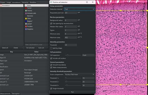 qupath positive cell detection not working for rendered rgb image