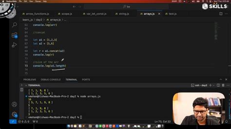 Vinay Kolhe On Linkedin Top1percenttechieswithvishwa Backenddevelopment Javascript Nodejs