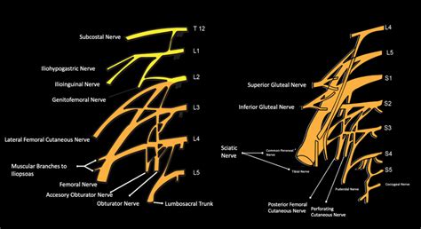 Lumbosacral Plexopathy