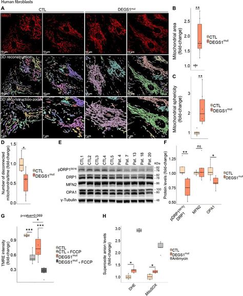 Mitochondrial Dynamics And Bioenergetics Impairment In Degs1patient
