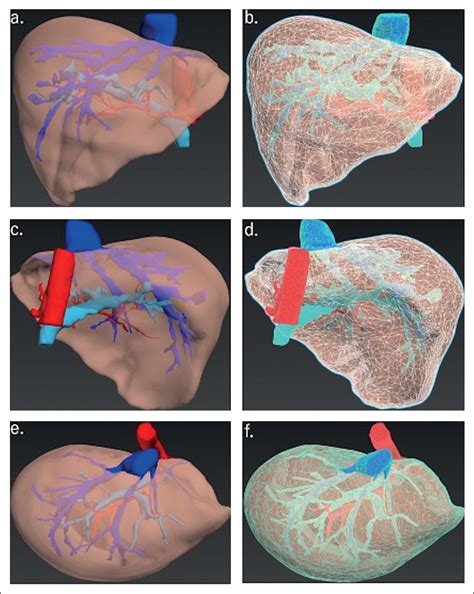 Modelo De Hígado Marcado Con Vena Porta Hepática Vista De La