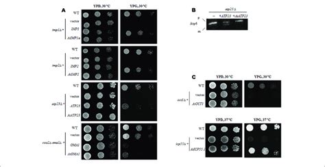 Functional Complementation Of Yeast Mutants Lacking The Respective Download Scientific