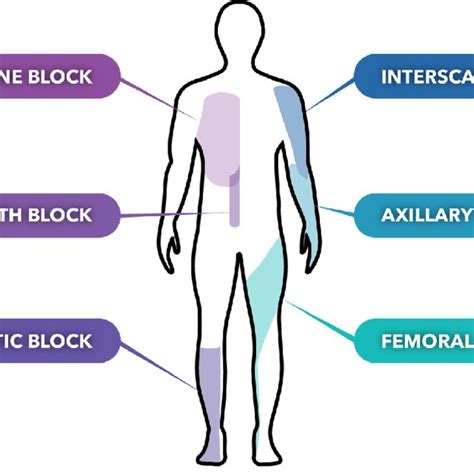 Examples Of Potentially High Value Versatile Nerve Blocks The Shaded