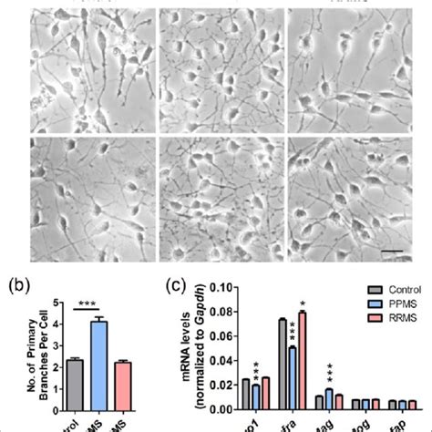 Pdf Multiple Sclerosis Patient Derived Csf Induces Transcriptional