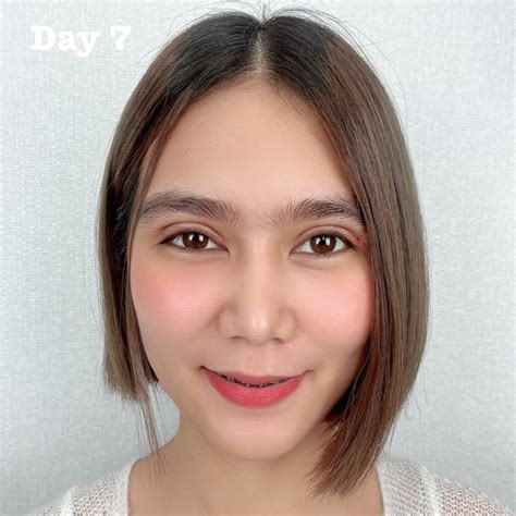 กรีดยาว Archives Doctor Garn Clinic คลินิกหมอกาญจน์ ศัลยกรรมตาสองชั้น