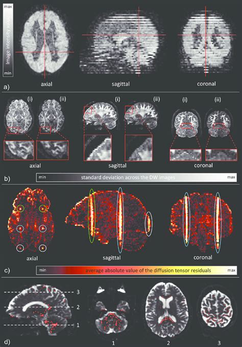 1 A Three Orthogonal Views For A Single Axially Acquired Download Scientific Diagram