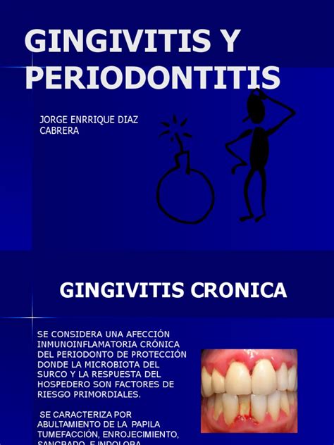 Gingivitis Cronica Pdf Inflamación Hueso