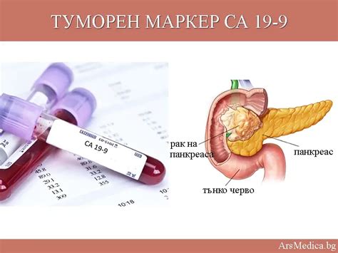 Видове гуша токсична нетоксична дифузна нодозна Arsmedica Bg