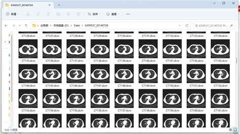 Dicom文件介绍 知乎