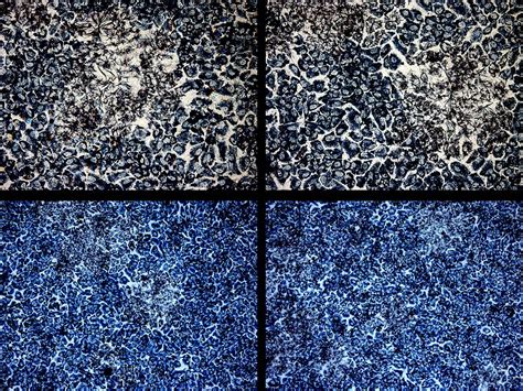 How Does One Interpret These Results Of Virus Plaque Assay