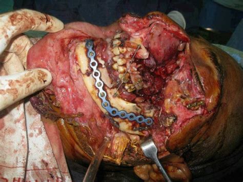 【閲覧注意】一体 何があった！？ 詳細不明の衝撃グロ画像（20枚） ポッカキットポッカキット