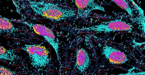 Henrietta Lacks Behind Hela Cells