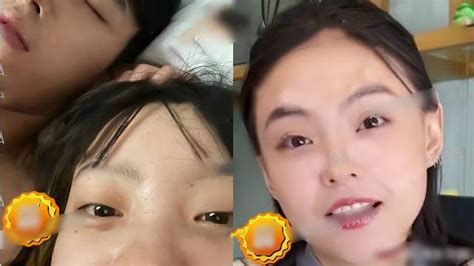 陈飞宇凸嘴因口呼吸 陈飞宇网红是亦琳吖床照视频公开了吗？梨抖网