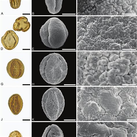 Fossil Fagaceae Pollen From The Ban Pa Kha Subbasin Light Microscope