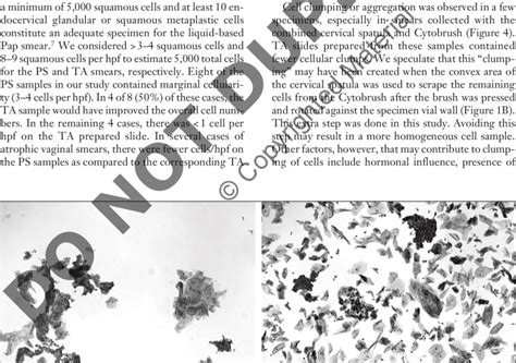 A Cervical Spatula And Endocervical Cytobrush Smears Demonstrating A